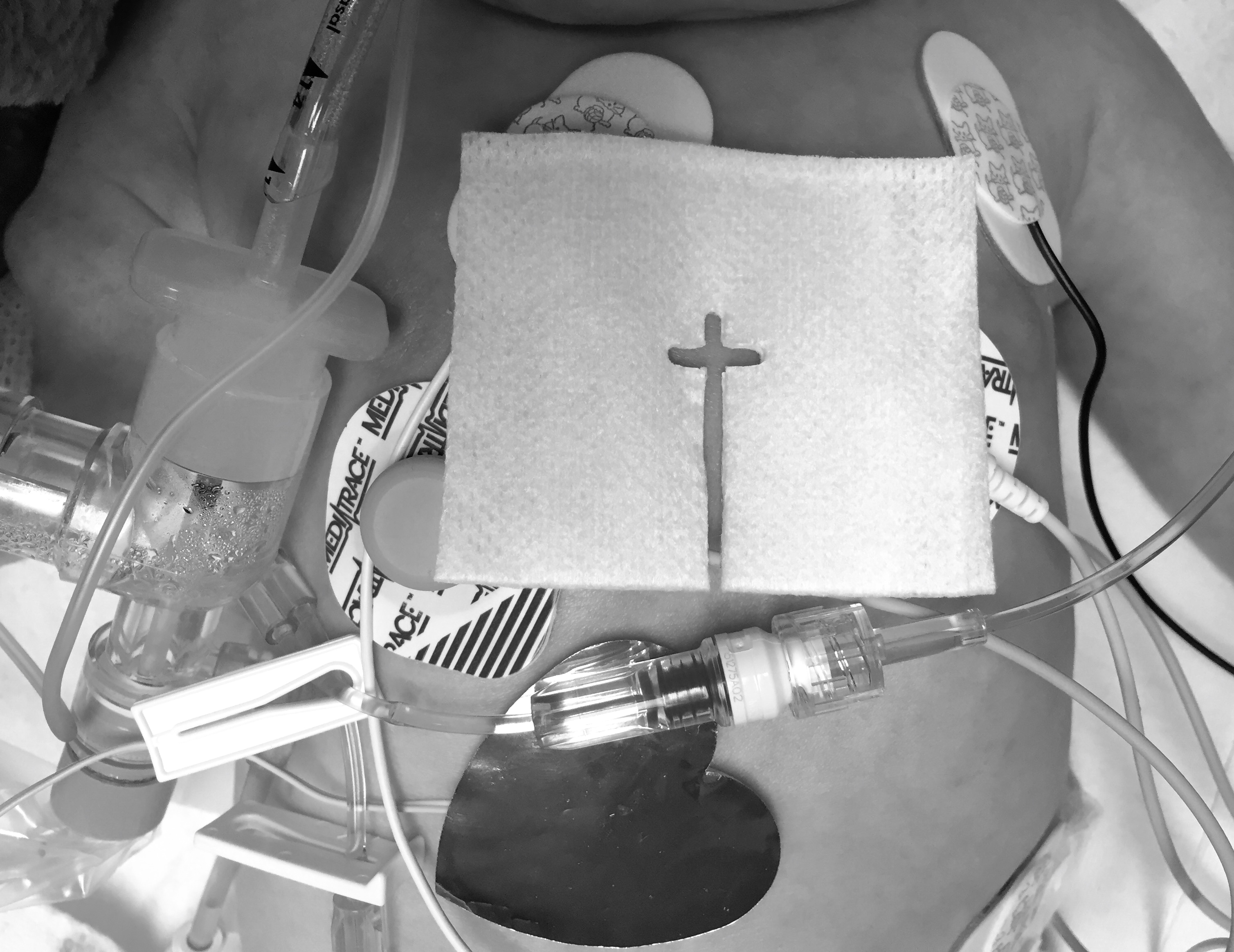 Drake Rayden, NKH disease, Greenville SC, Glycine, NKH foundation