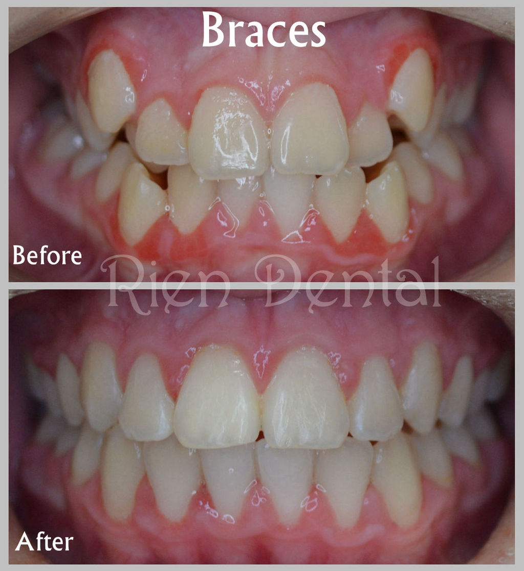 Rien Dental - Dentist in Mentone, Bayside, Melbourne