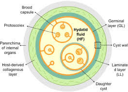 Hydatid Disease (Part IV)