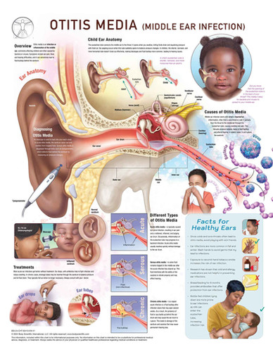 Otitis Media (Middle Ear Infection) | BSI Catalog