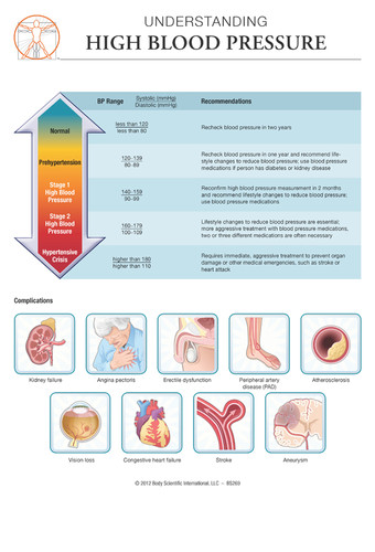 High Blood Pressue - Anatomical Wall Chart | BSI Catalog
