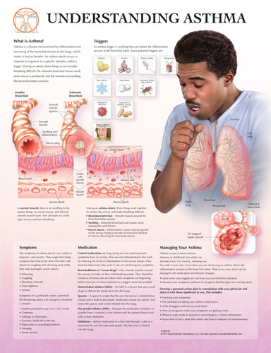 Understanding Asthma (African) | BSI Catalog