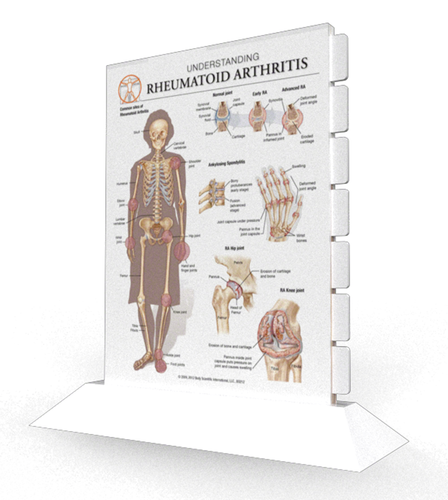 Rheumatoid Arthritis - Multi-tab Slider Model | BSI Catalog