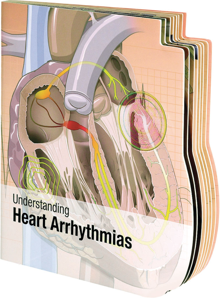 Understanding Heart Arrhythmias - Lenticular Book | BSI Catalog