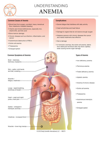 copy of Anemia - Anatomical Wall Chart | BSI Catalog