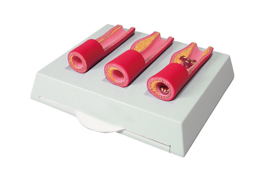 3 Artery - Model | BSI Catalog