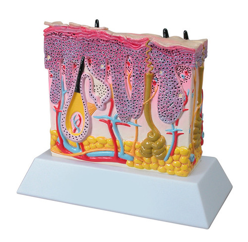 Psoriasis Skin - Model | BSI Catalog