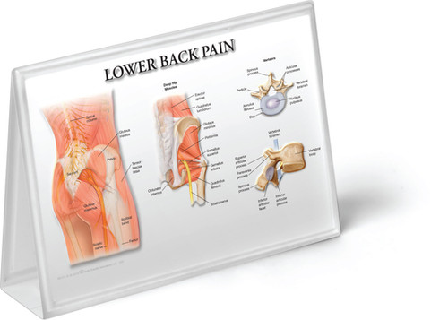 Low Back Pain - Anatomical Tent Chart | BSI Catalog