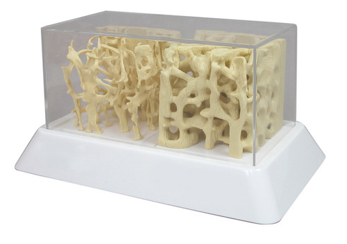 Bone Density - Model | BSI Catalog