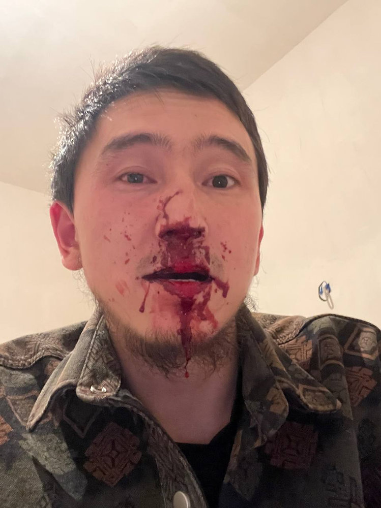 Brutal Attack On Kyrgyz Preacher For Peaceful Religious Dialogue Brutal Attack On Kyrgyz Preacher For Peaceful Religious Dialogue