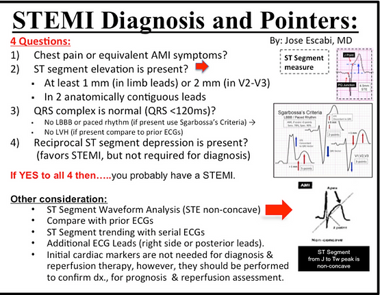 Mastering STEMI ECG