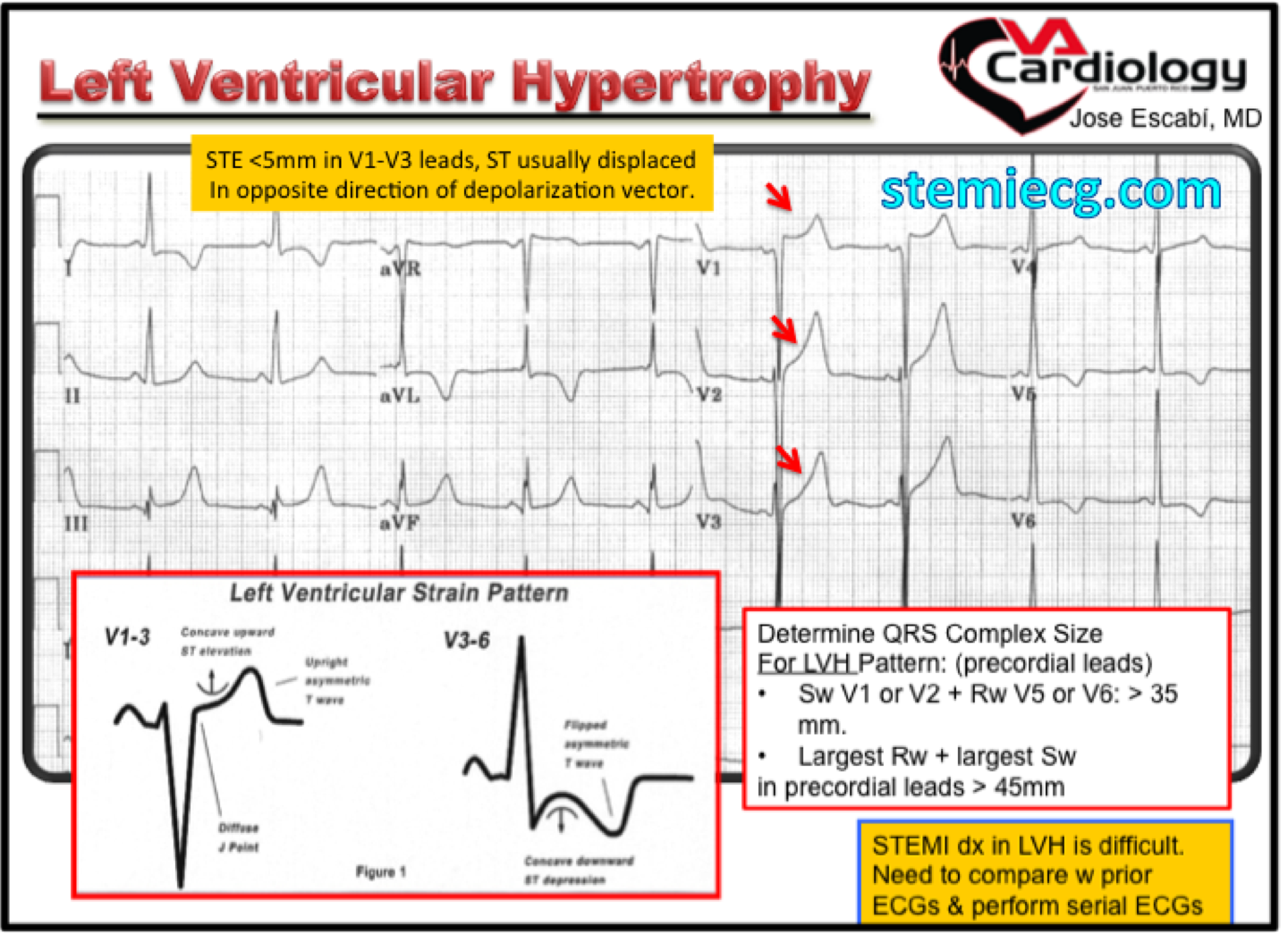 Mimicking ECGs