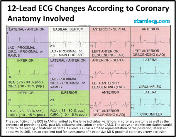 Mastering STEMI ECG