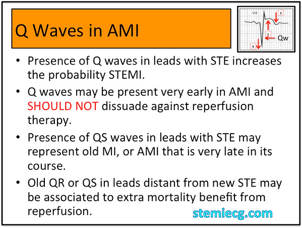 Mastering STEMI ECG