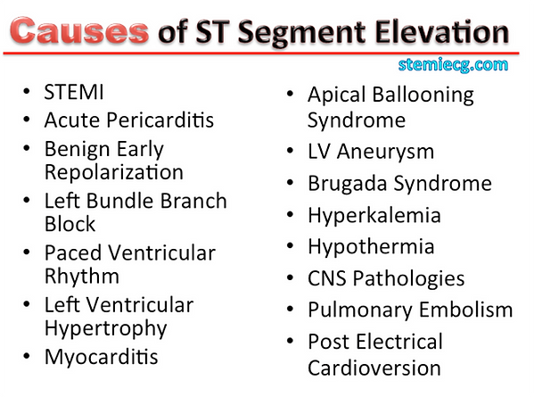Mastering STEMI ECG