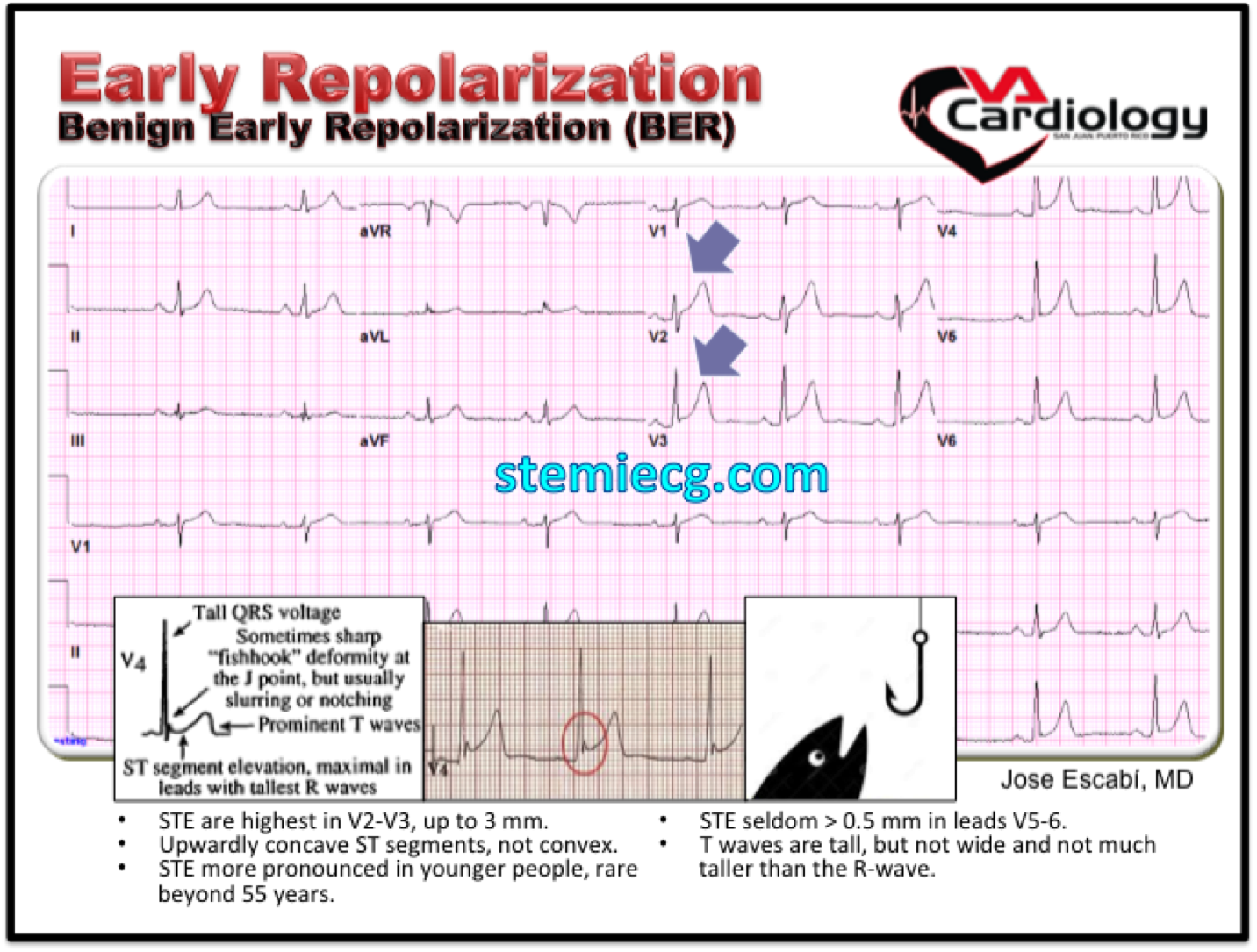 Mimicking ECGs