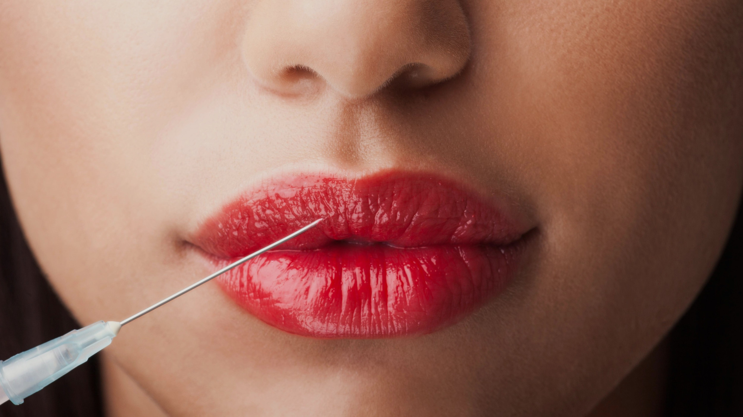 Lip Fillers | You & I Medical Aesthetic Spa