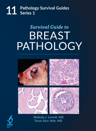 Survival Guide to Breast Pathology | Innovative Pathology