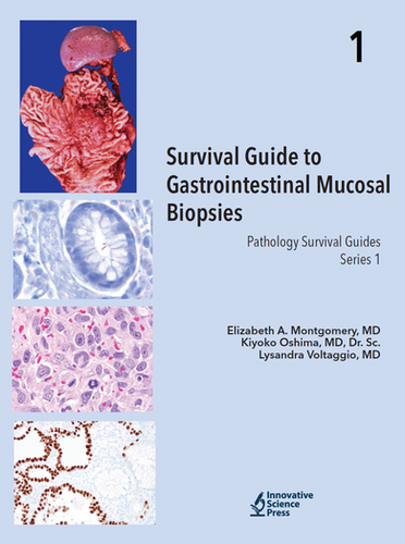 Survival Guide to GI Mucosal Biopsies | Innovative Science Press