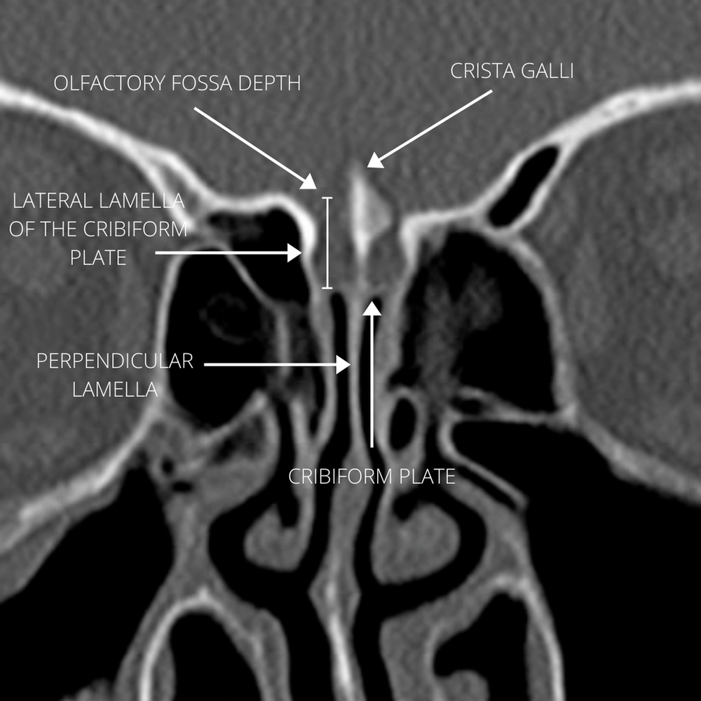 Clasificación de Keros
