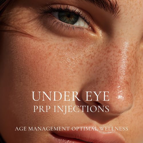 PRP Under Eye Injections | Age Management Optim
