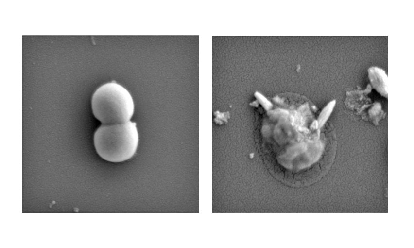 Fighting drug-resistant superbugs with bacteria-shredding nanoparticles