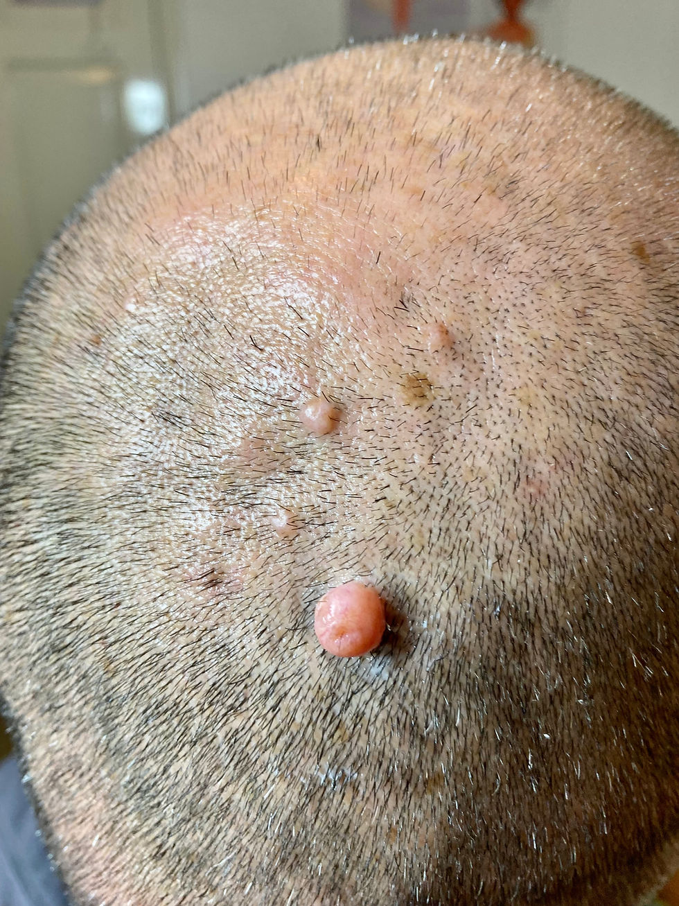 Before&After | Cj Skin Clinic