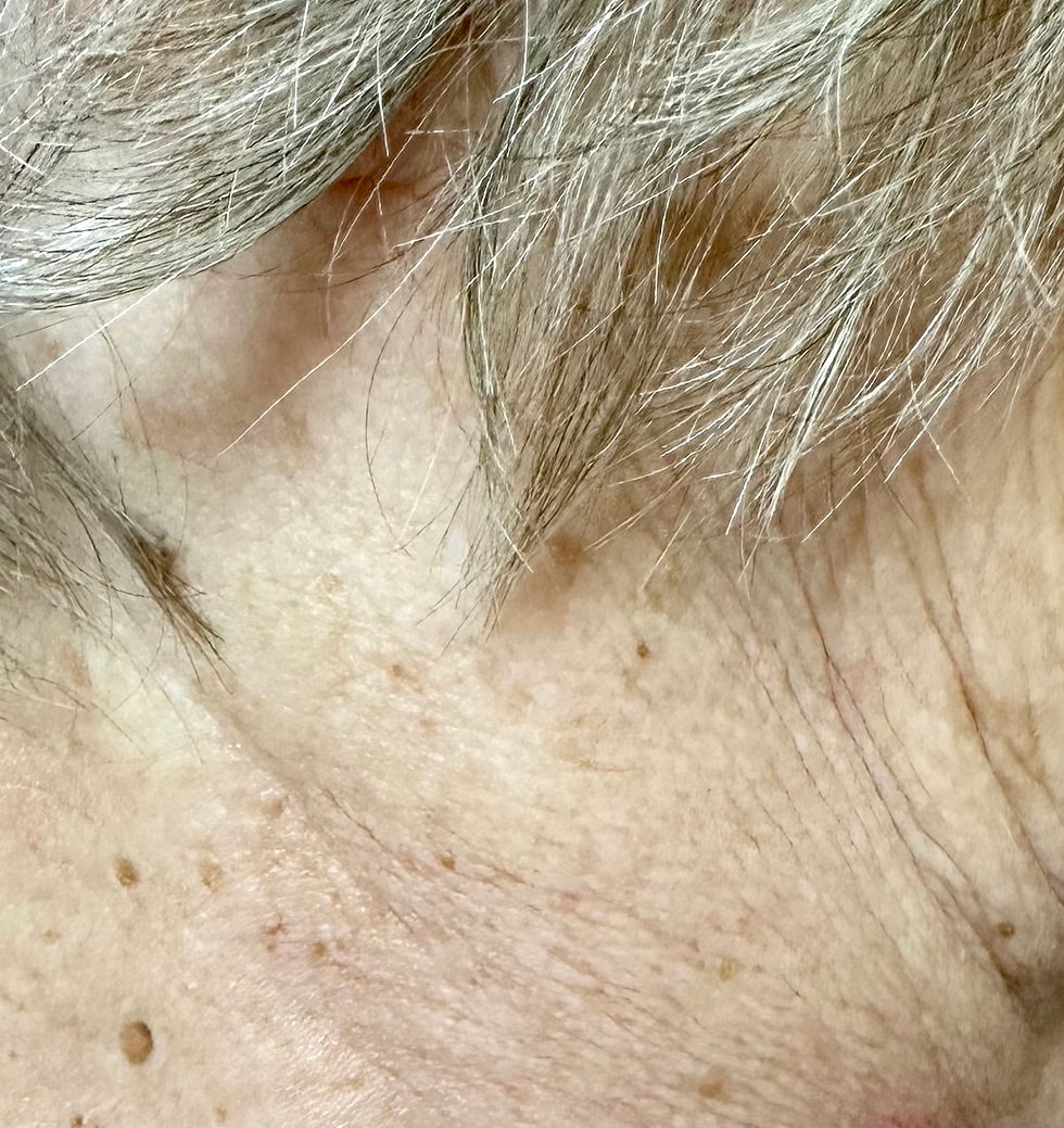 Before&After | Cj Skin Clinic