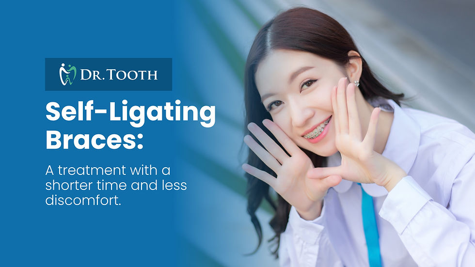 Pendakap Gigi Konvensional vs. Pendakap Gigi Self-Ligating: Memilih Pilihan yang Tepat untuk ...