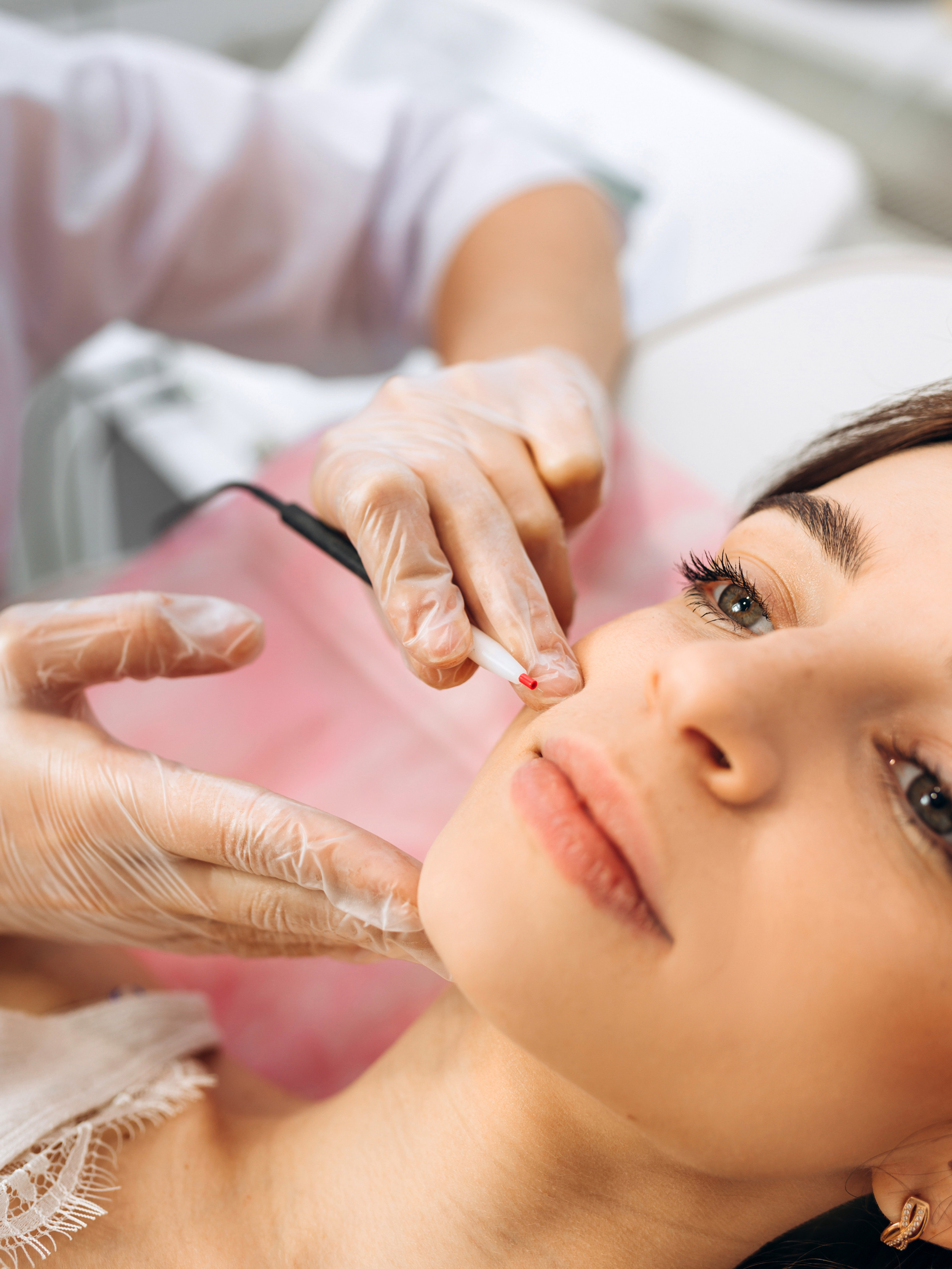 Best Vasculyse Treatments in Brampton | Five Senses Spa