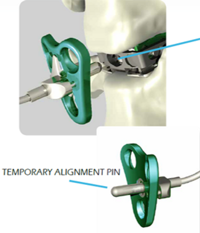 V3 SEGMENTAL PLATE | Atlas Spine