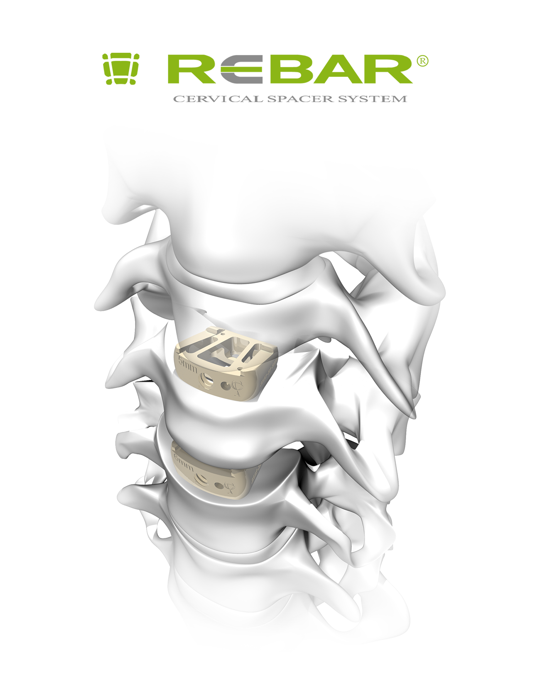TECHNOLOGIES | Atlas Spine