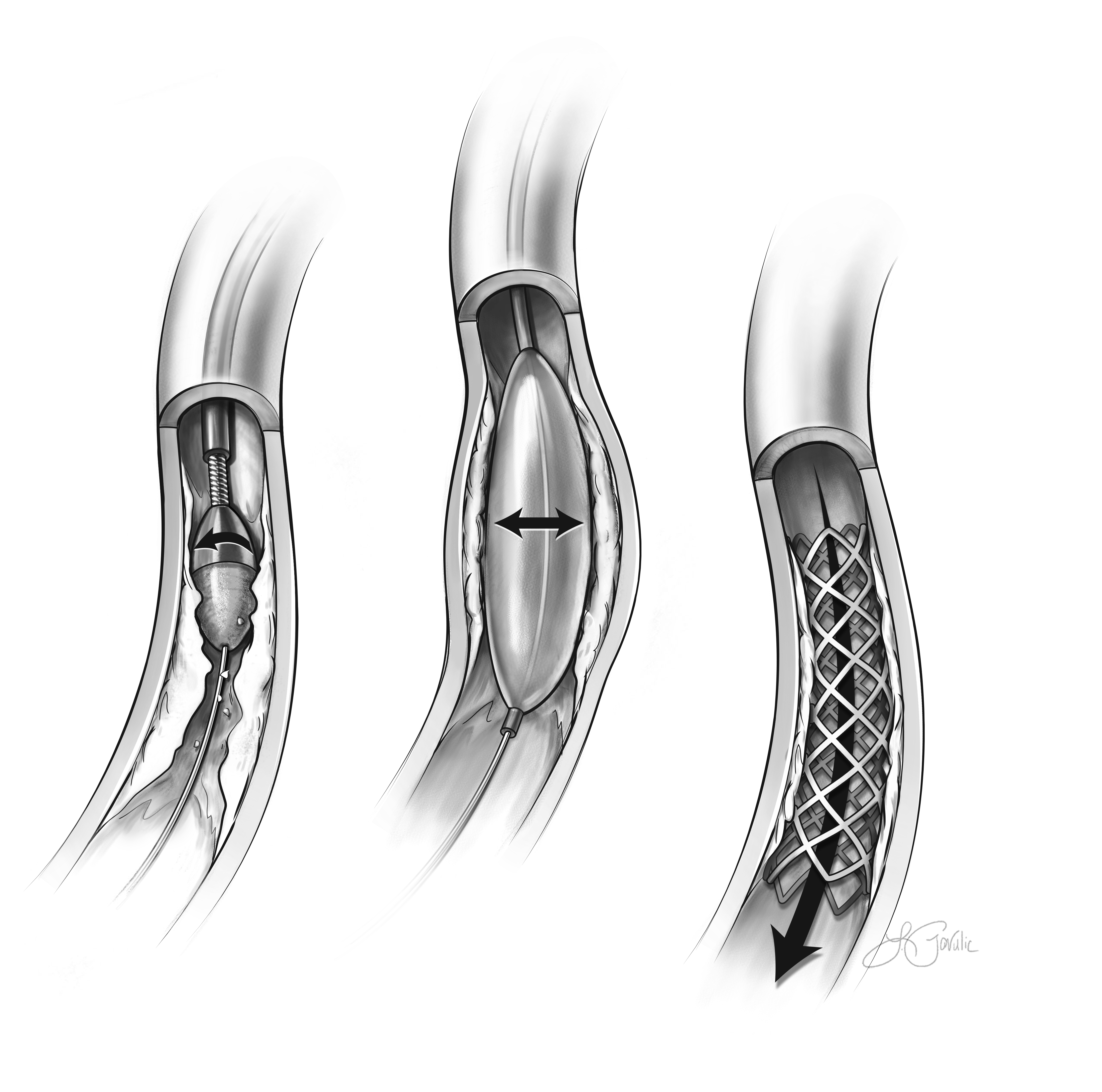 ILLUSTRATION | lgavulic