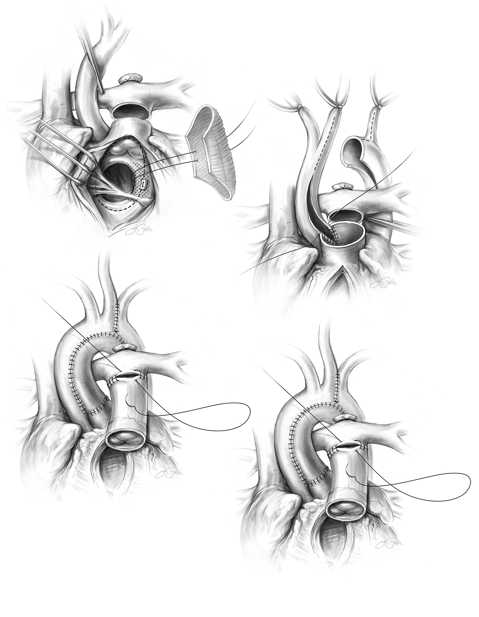 ILLUSTRATION | lgavulic