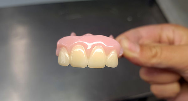 3D printed partial dentures | Zei Kagaoan