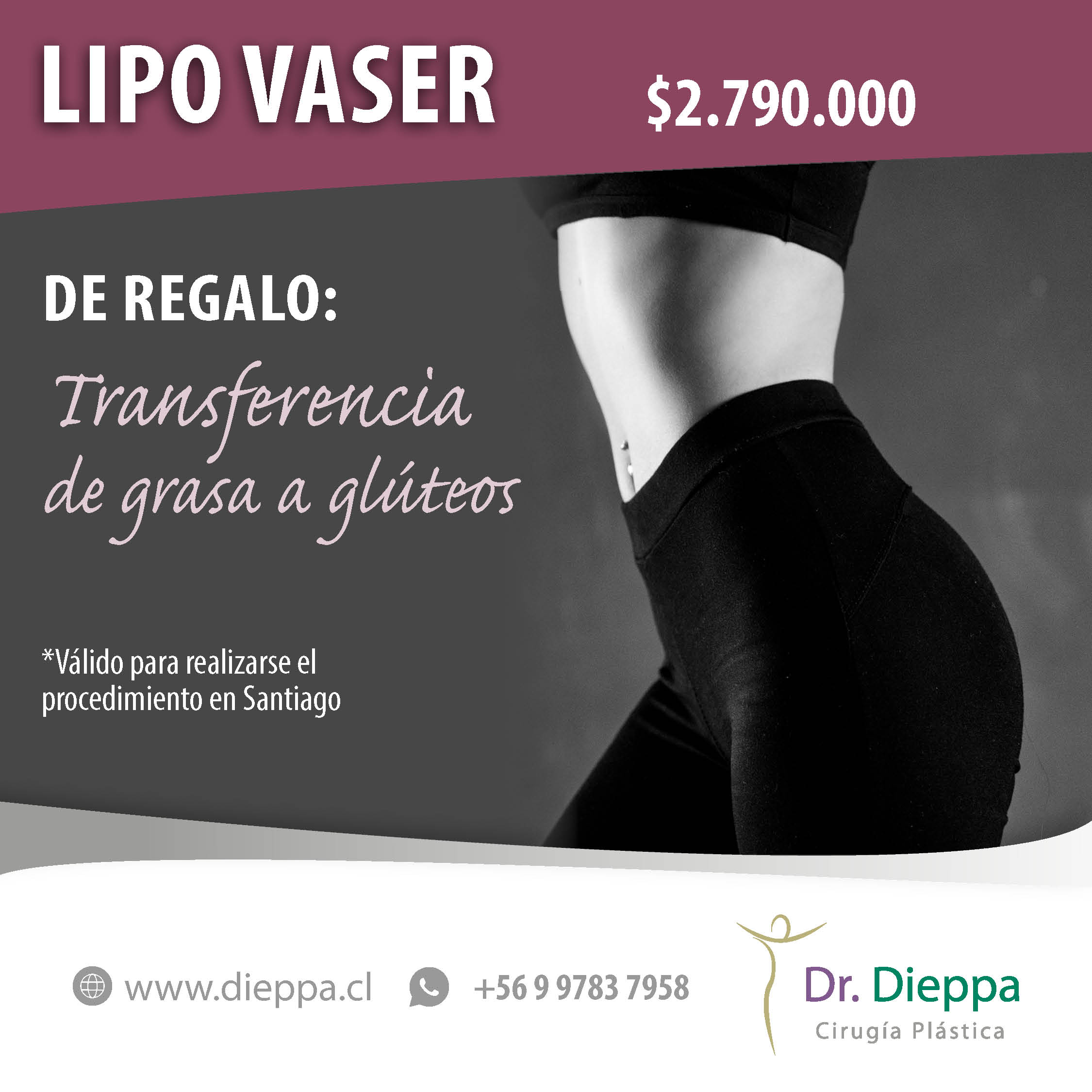 Lipo Vaser en Promo de verano!!!
