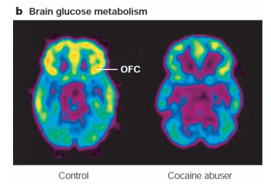 The Neuroscience Of Addiction Chapter 1 ‒ Choice