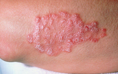 Contra-indications and Contra-actions