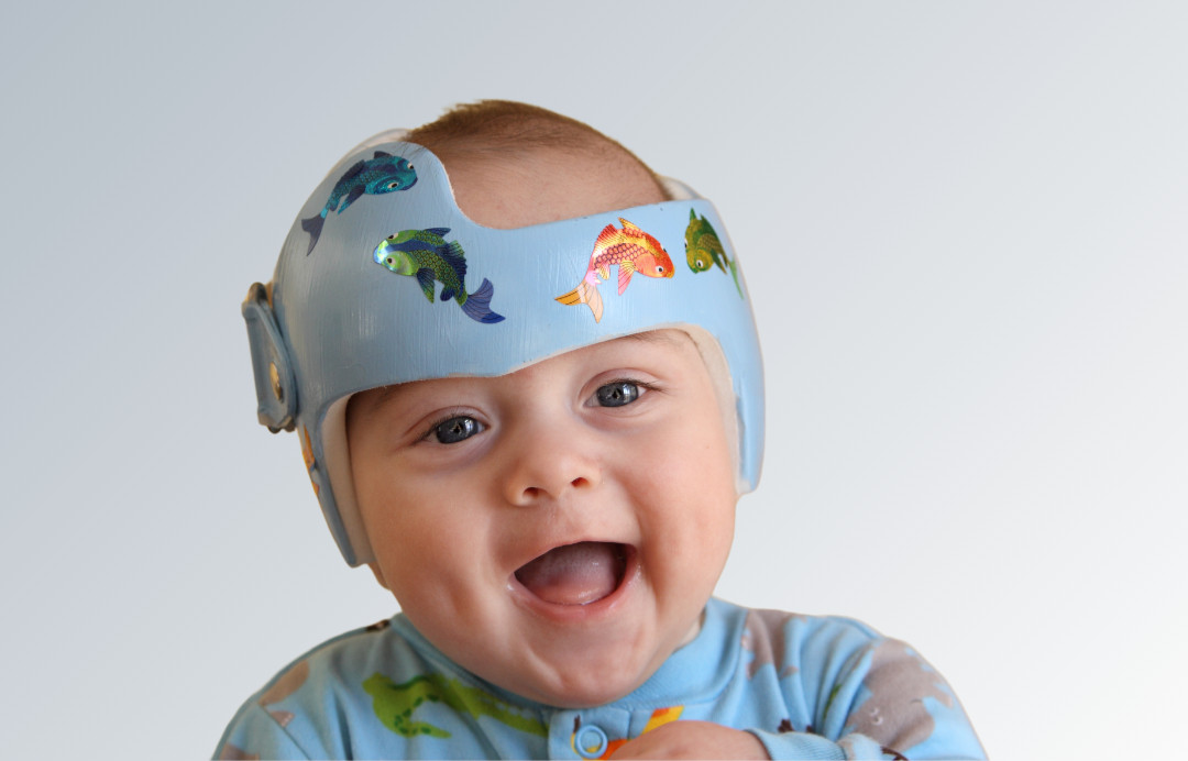 Infant Flat Spots: When to Worry & What to Do