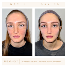 Harley True: Master Advanced Esthetician | skincare | Portland