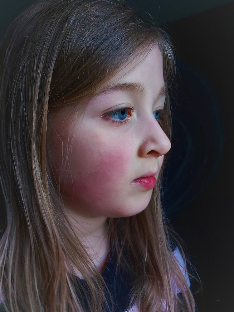 Are we facing a surge of Long Covid with Paediatric Acute-Onset ...