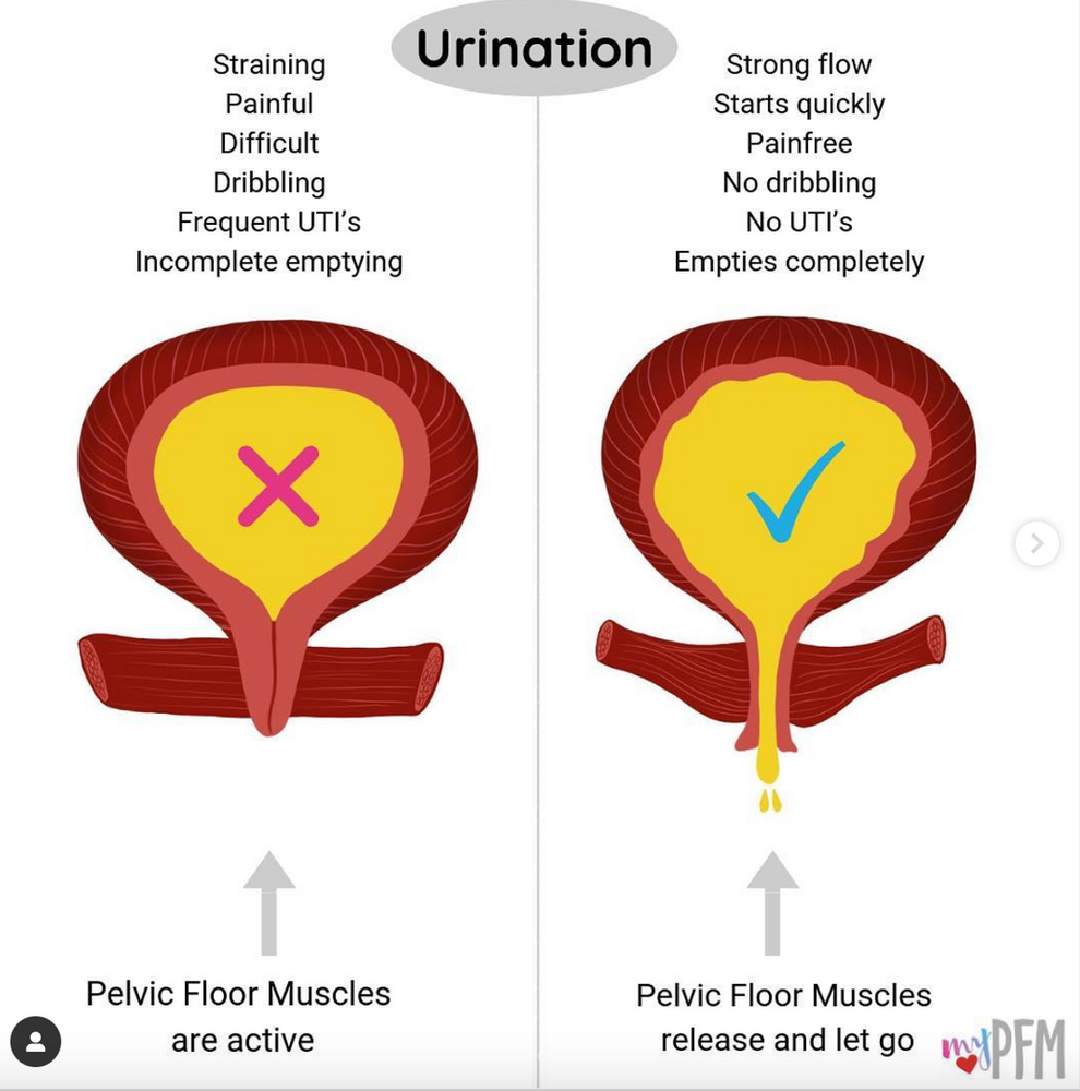 What Is Urinary Retention 