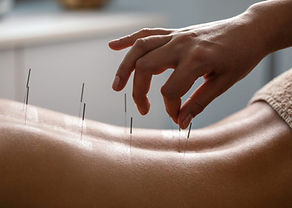 asante acupuncture