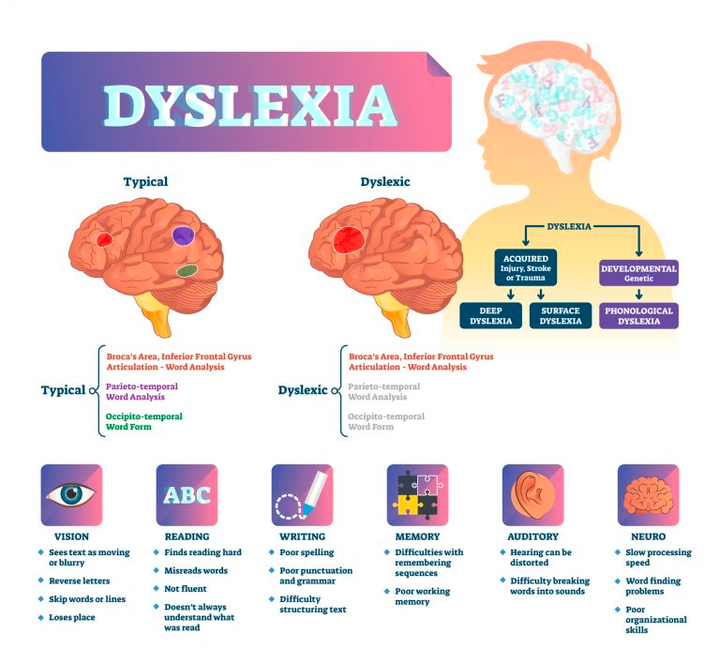 Vision & Dyslexia | Vision & Learning Center