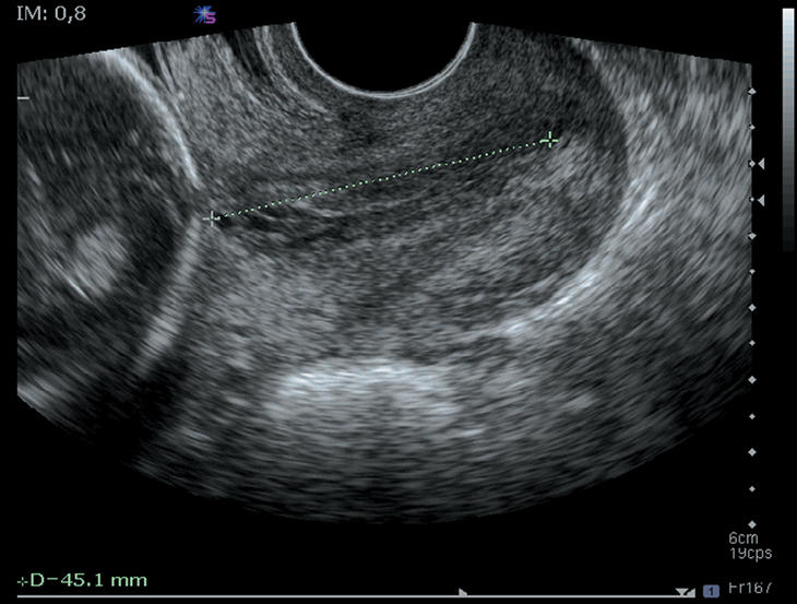 ¿Sabes lo que es el Check Up Primer trimestre? (embarazo)