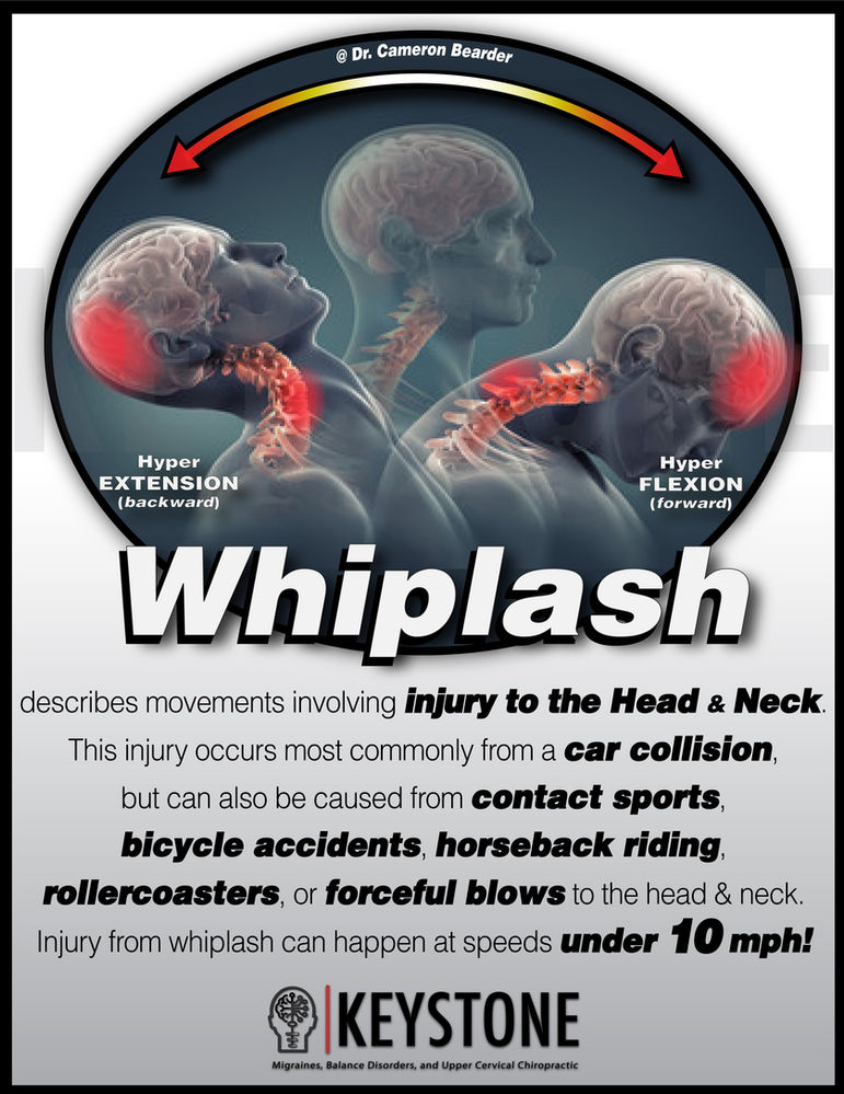 What does whiplash mean?