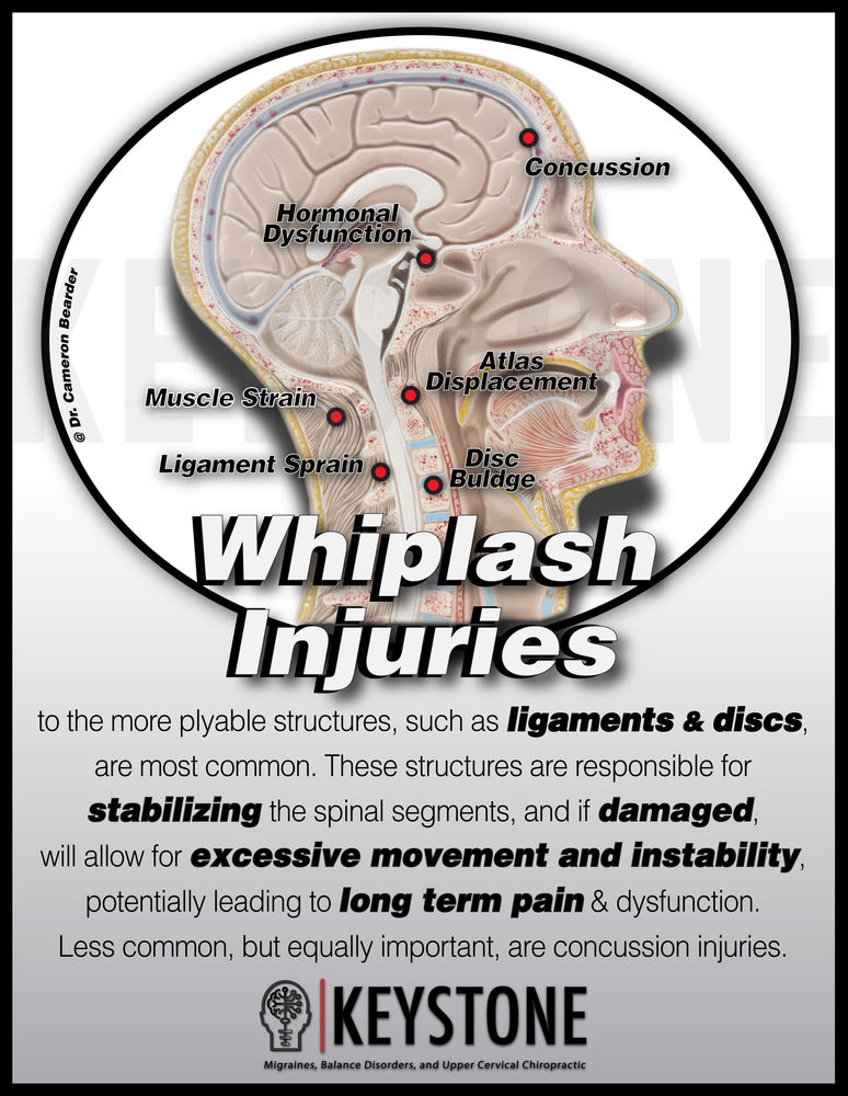 What does whiplash mean?