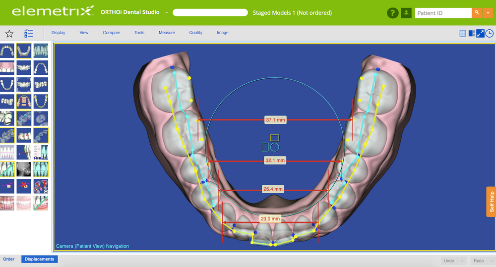Digital Study Model - The beginning of everything