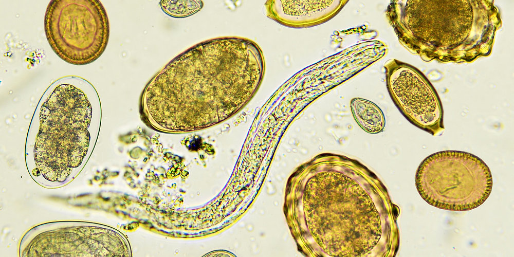 Are Parasites the Root Cause of Your Health Problems?