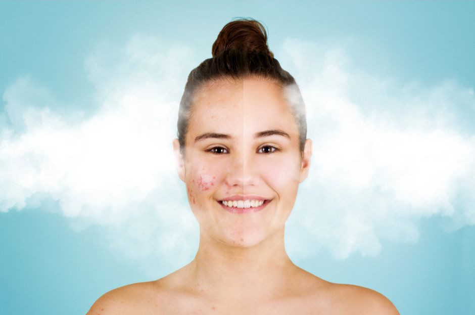Can Cryotherapy Damage Skin? Understanding the Risks and Benefits